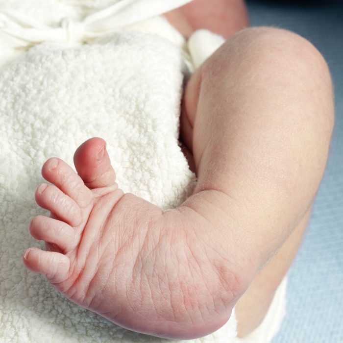 How Fetal Constraint Affects Babies: Things We Notice After Birth